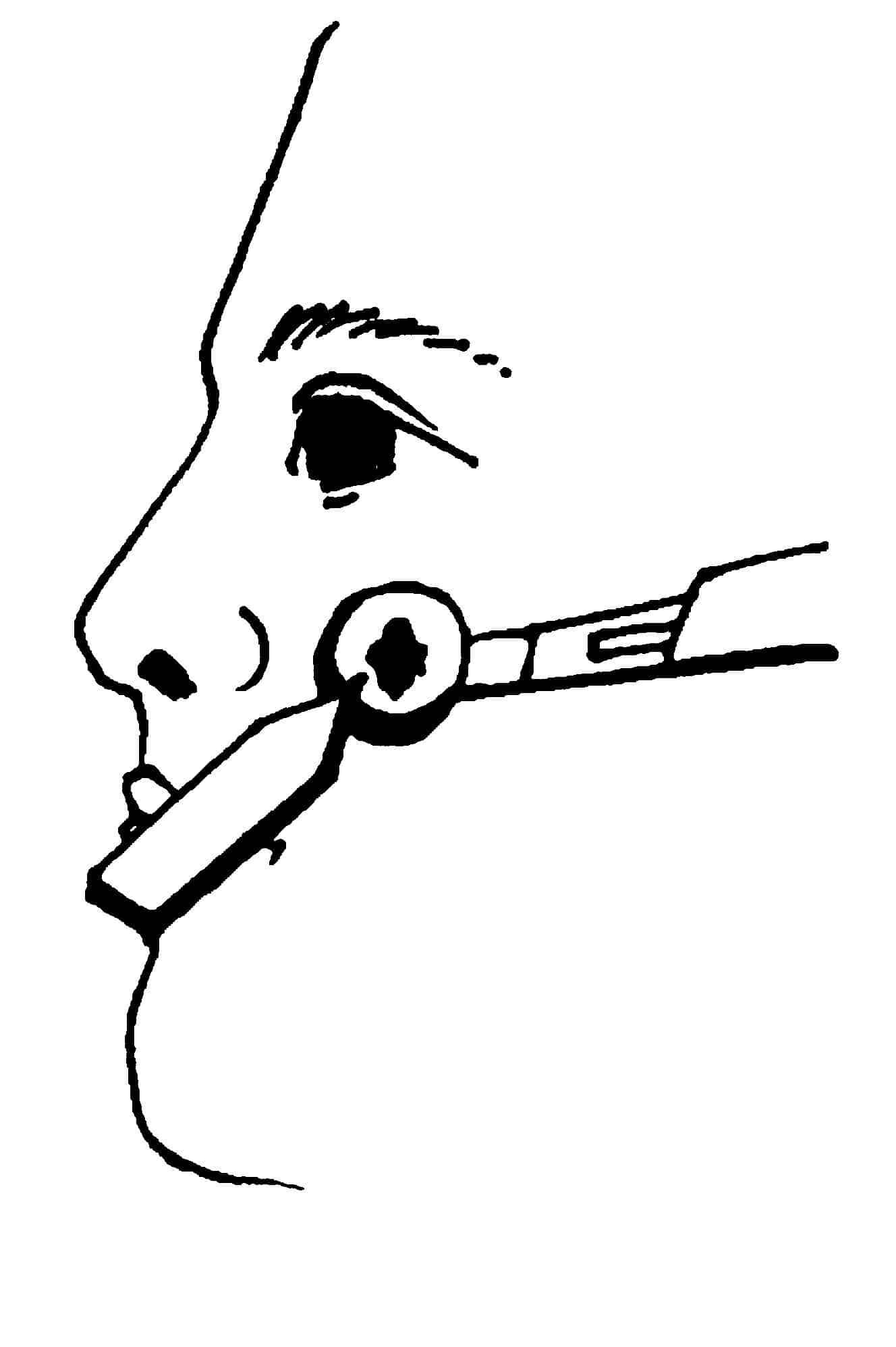 Mohs Surgery Procedure - Central Texas Dermatology