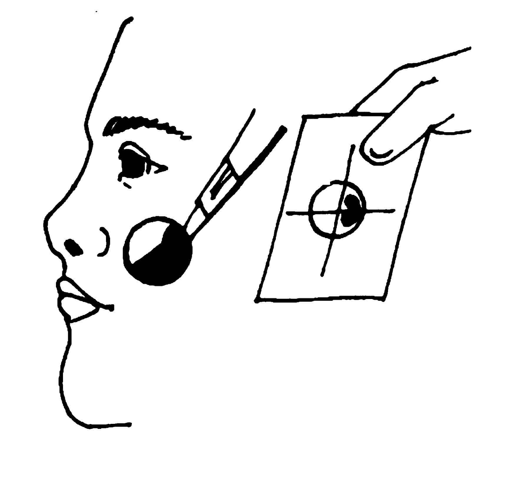 Mohs Surgery Procedure - Central Texas Dermatology